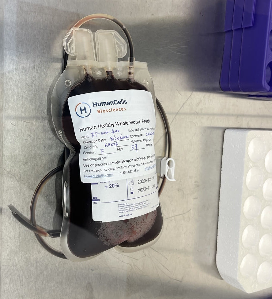 Buy Human Healthy Donor Whole Blood, Fresh from HumanCellsBio.com ...