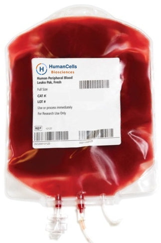 Buy HIV-1 Patients PBMCs (HIV PBMC) Leukopak, Whole Blood and Plasma ...